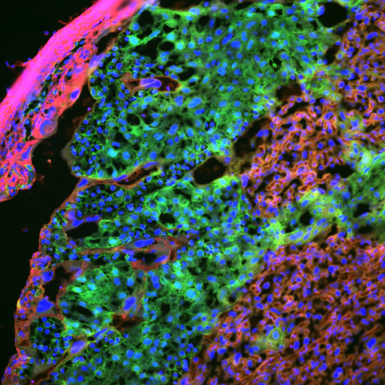 New clues on immune memory revealed by epigenetic studies